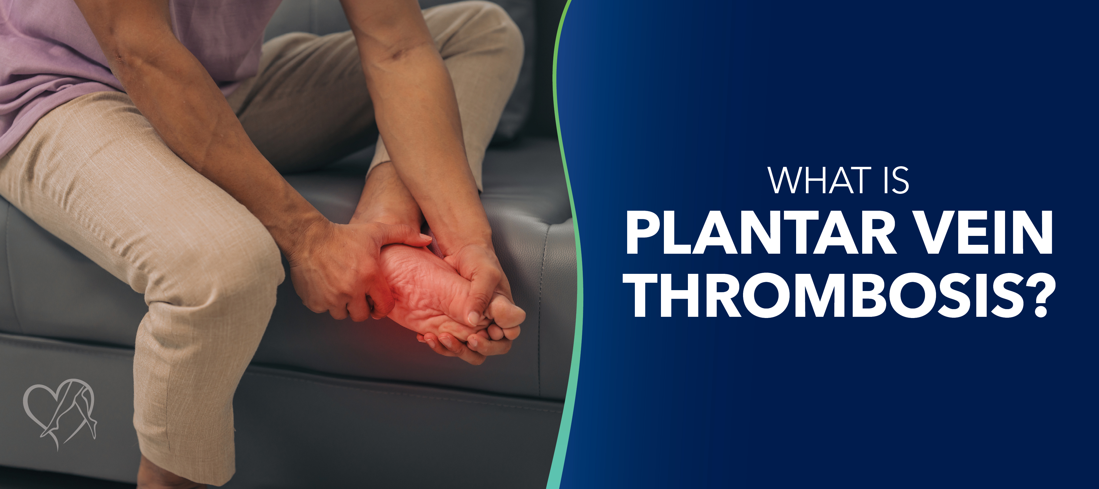 Lateral Plantar Vein