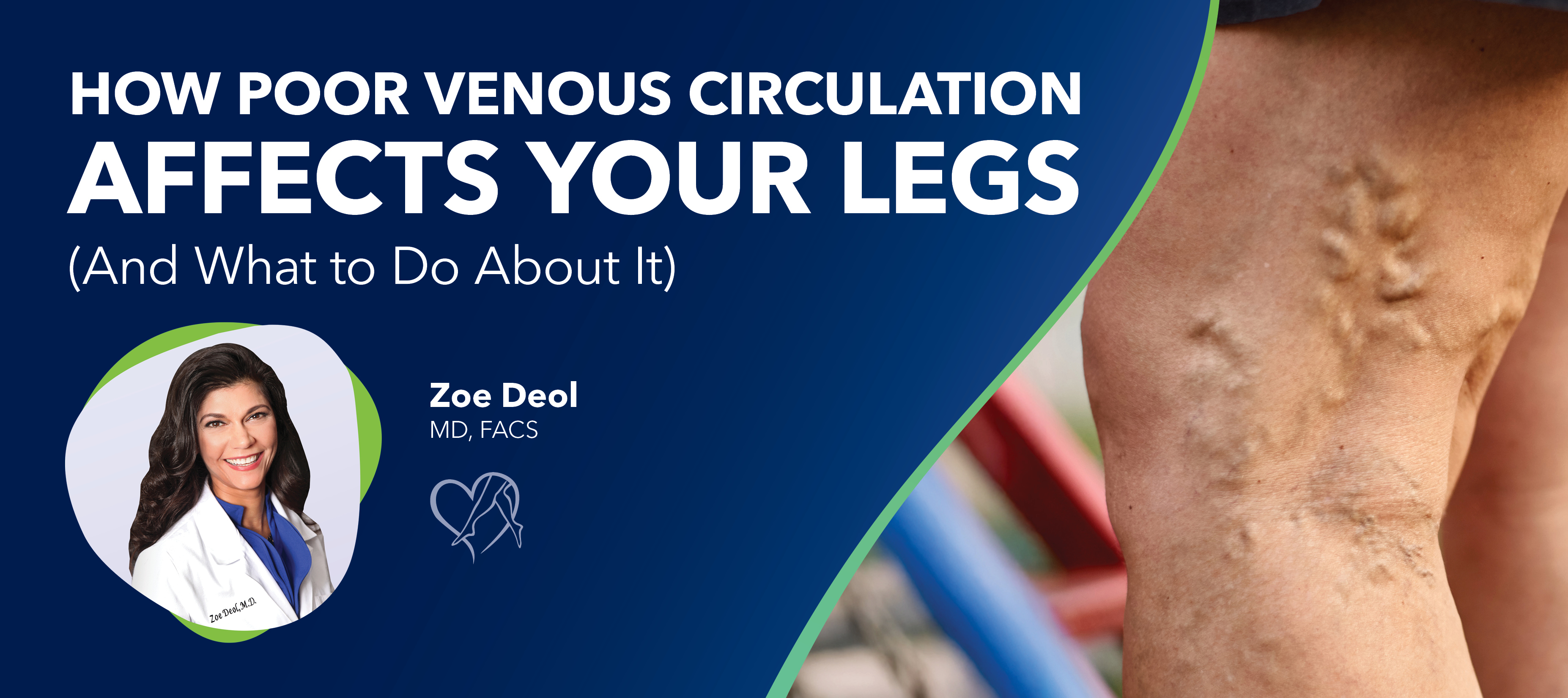 The Disease Of Bad Circulation In Legs